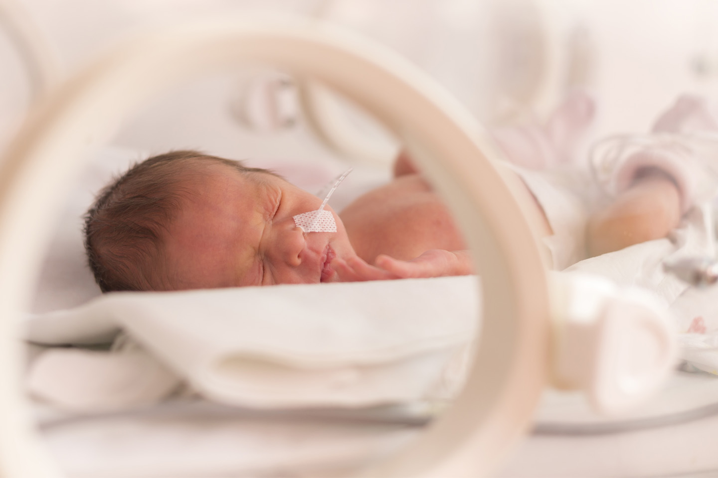 Infant Care Innovation Improves Outcomes for Preterm Infants | Adelphi ...